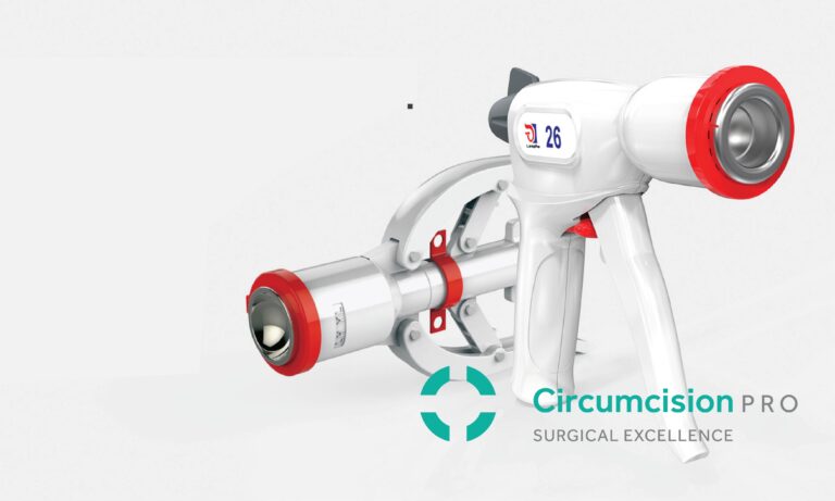 Exploring the Advantages of the CircCurer Stapler Device in Paediatric ...